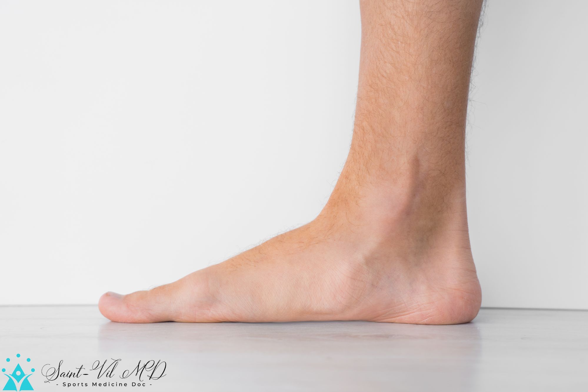 Close up of mans bare foot with strong flat feet also called pes planus ...