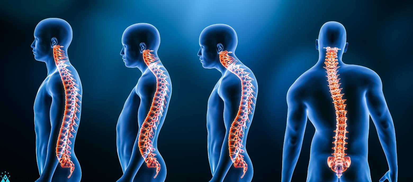 Three main curvatures of the spine disorders or deformities on male ...