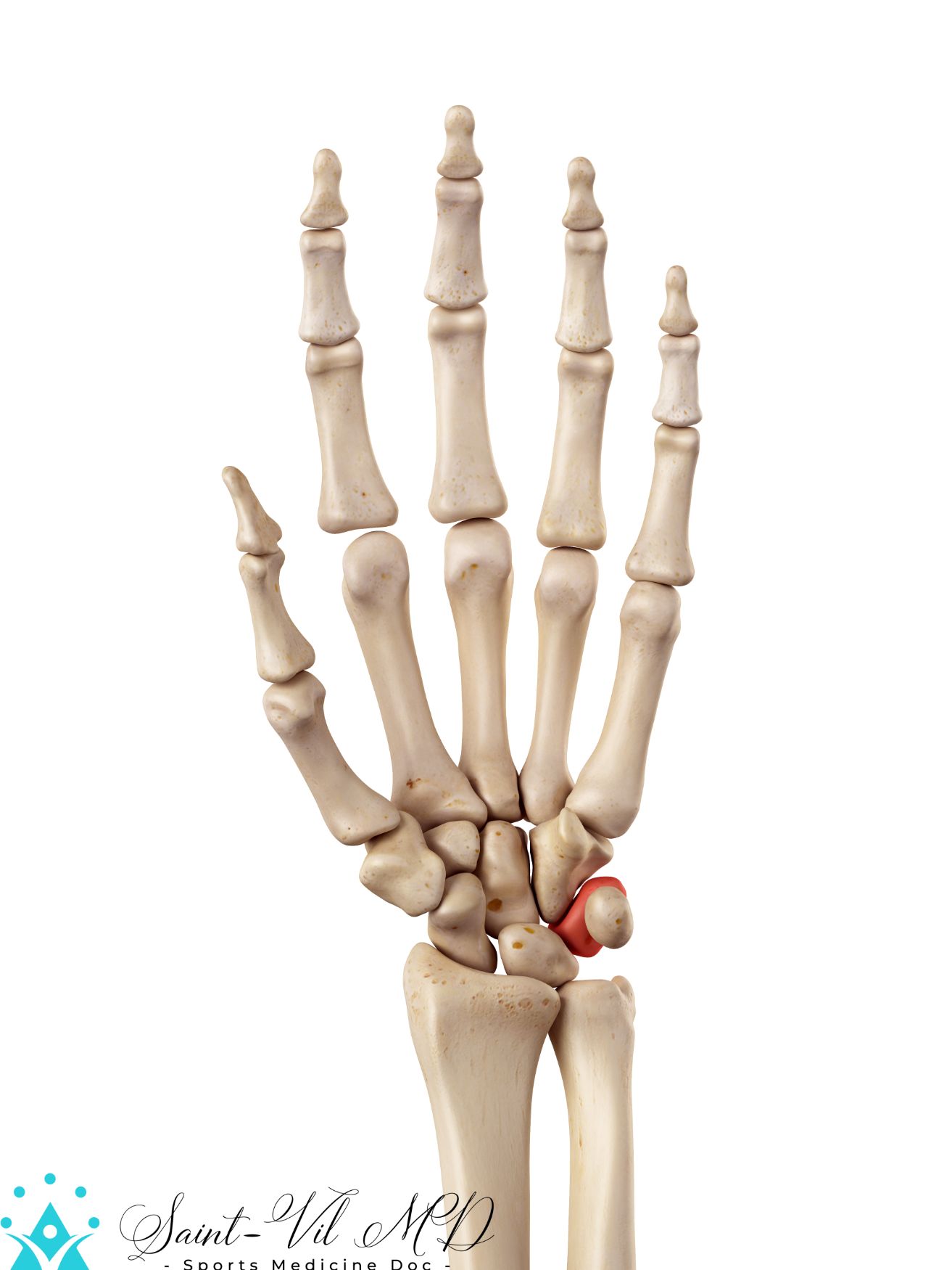 medical accurate illustration of the triquetrum bone - ExerciseNow