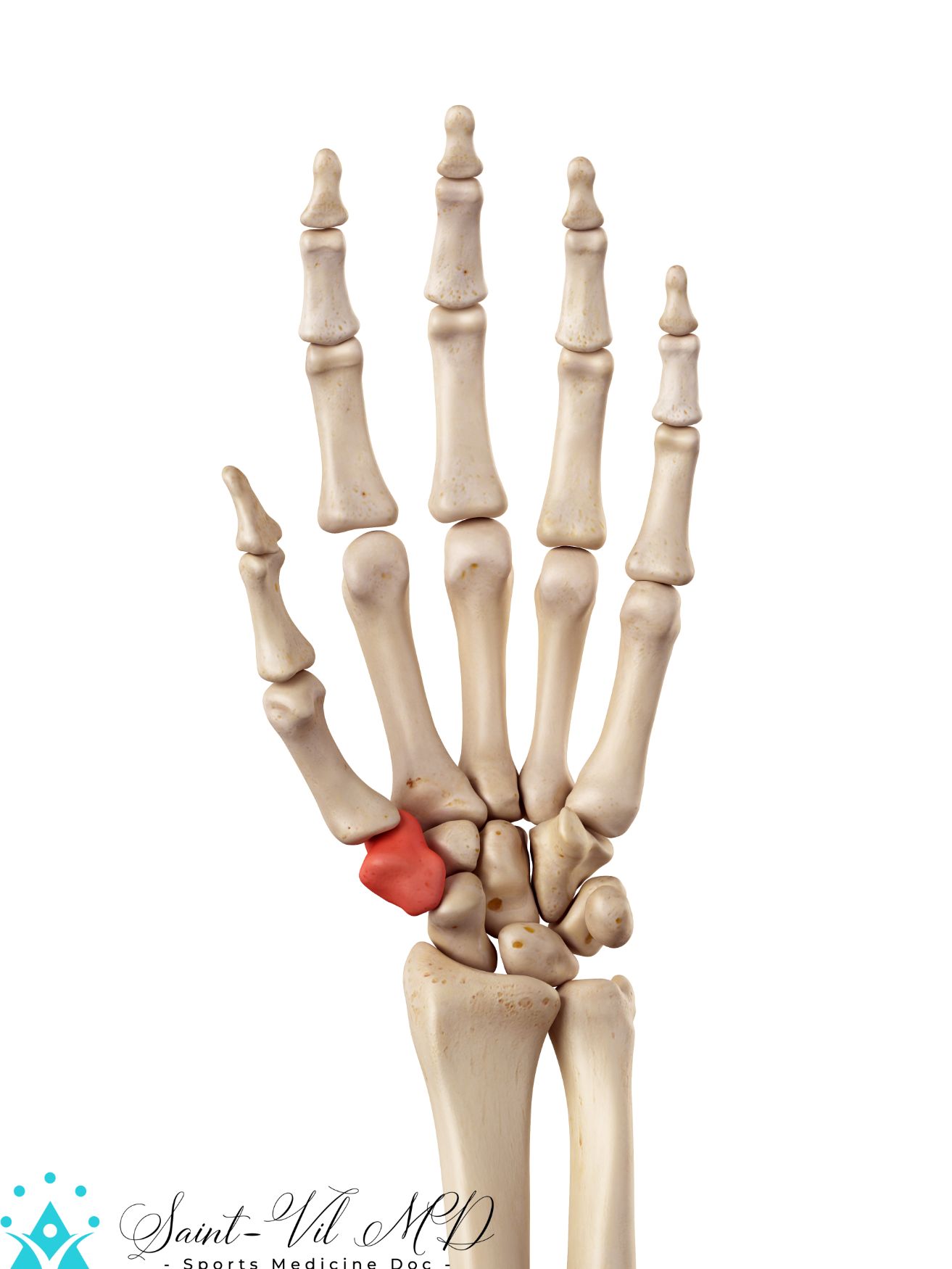 medical accurate illustration of the trapezium bone - ExerciseNow