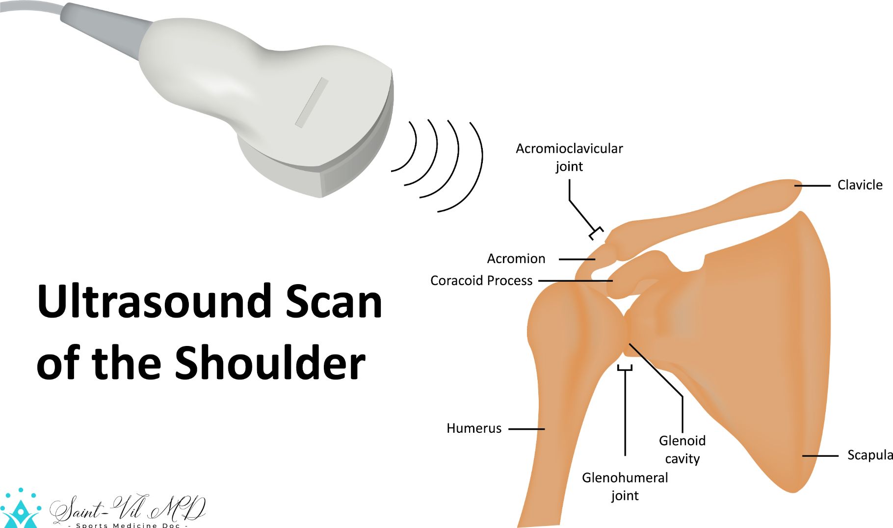 Ultrasound Scan of Shoulder Illustration - ExerciseNow
