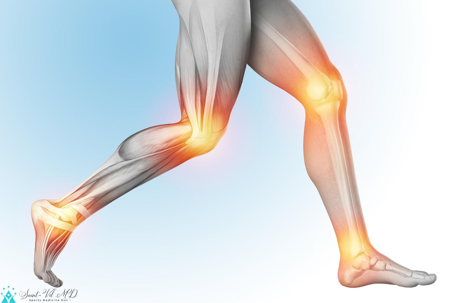 Medical illustration of a leg pain in anatomy transparent view. The ...