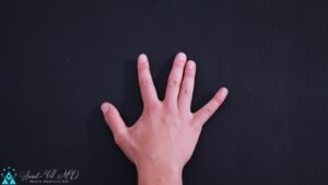 Finger Range of Motion Exercise Handouts - ExerciseNow