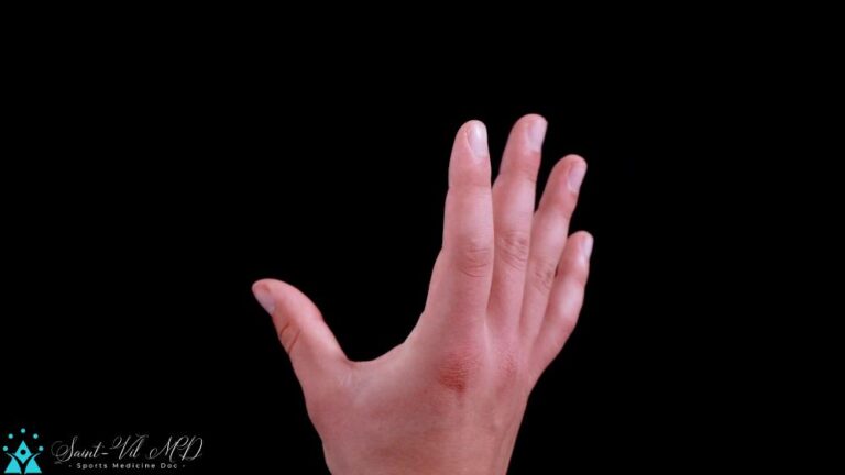 Finger Range of Motion Exercise Handouts - ExerciseNow